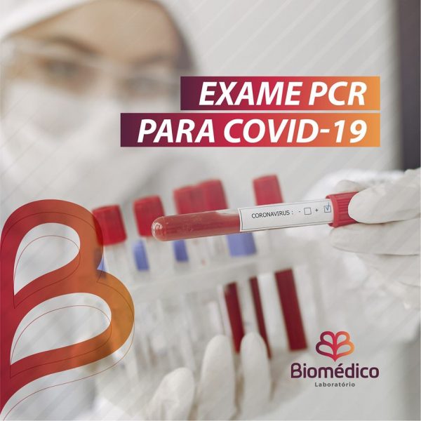 Exame PCR para COVID-19 - Biomédico Laboratório